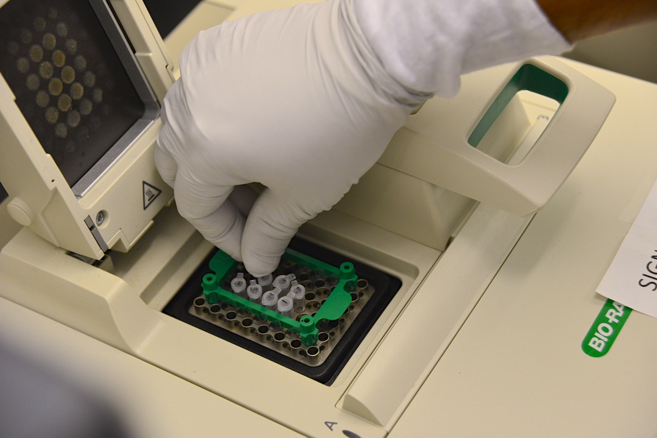 Recycling Mitochondria